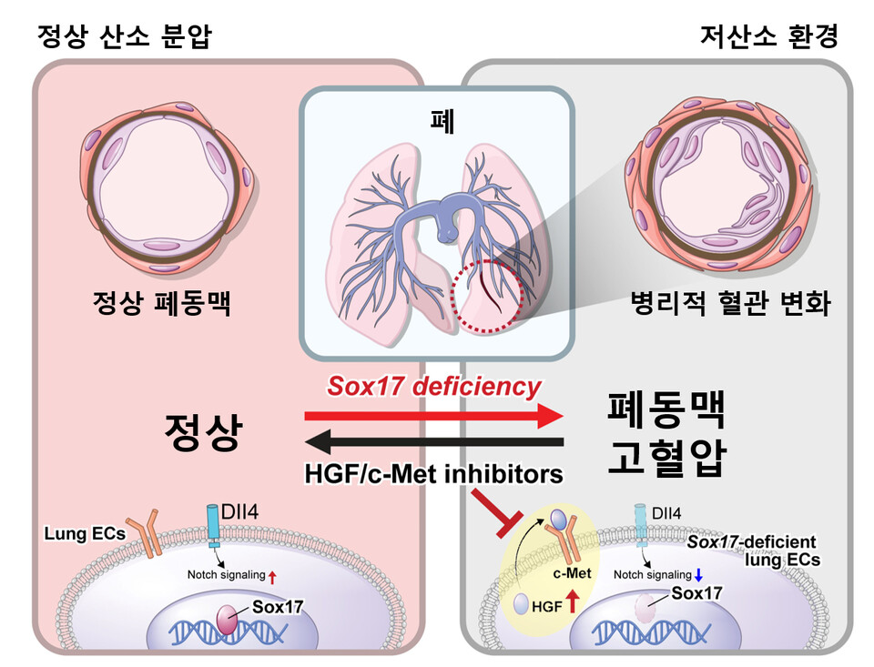 Sox17 유전자 결핍 시 저산소 환경 노출되면 폐동맥 고혈압 악화될 가능성 높아
