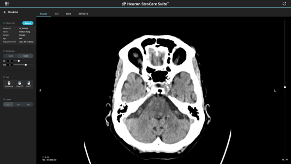 휴런, ‘Heuron StroCare Suite’ 혁신 의료기술 지정, 건강보험 진입