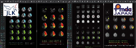 제이엘케이, 뇌졸중 솔루션 2개 'JLK-CTP⸱JLK-PWI' 日 PMDA 인허가 신청 완료