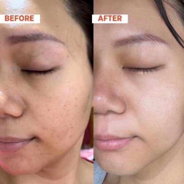 Korean Clinical Trials Prove Exosomes, Peptides and Spicules ...