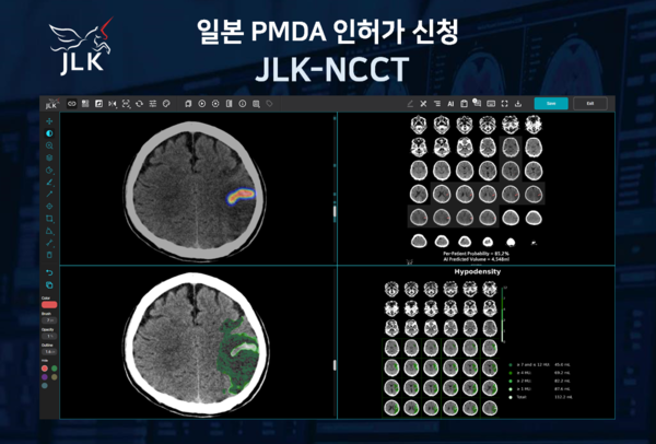 제이엘케이, 뇌졸중 AI 솔루션 ‘JLK-NCCT’ 일본 PMDA 신청…“세계 3위 의료시장 정조준”