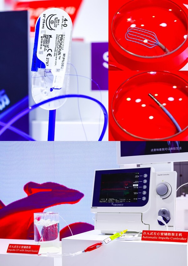 首秀云集，精彩纷呈----强生多款新品于第七届进博会首日发布