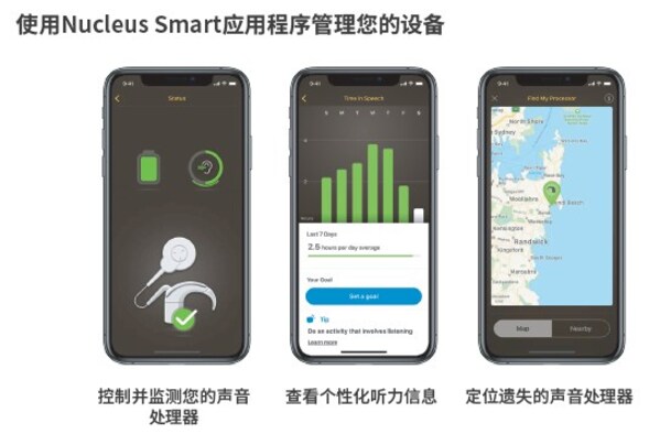科利耳推出一体式人工耳蜗声音处理器Nucleus™ Kanso™ 2